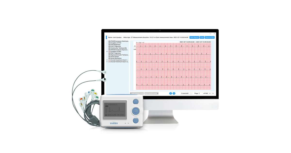 Viatom TH12 12 elvezetéses 24 órás mini EKG holter monitor | Pepita.hu