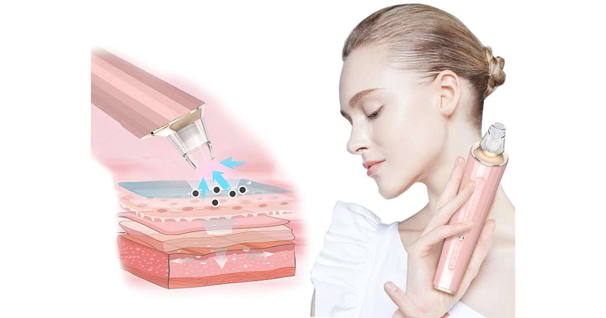 Vákuumos miteszer eltávolító | Pepita.hu